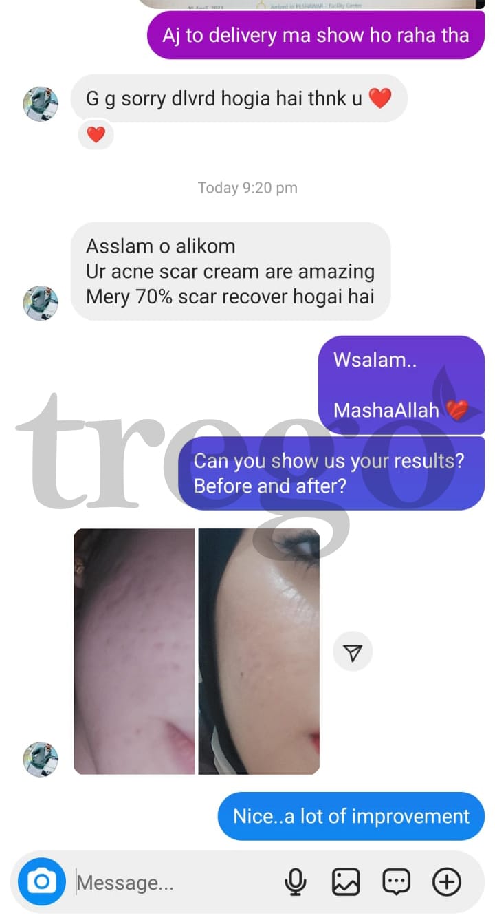 Skin Charisma helps Skin from Harmful Skin Infestation in Pakistan ...